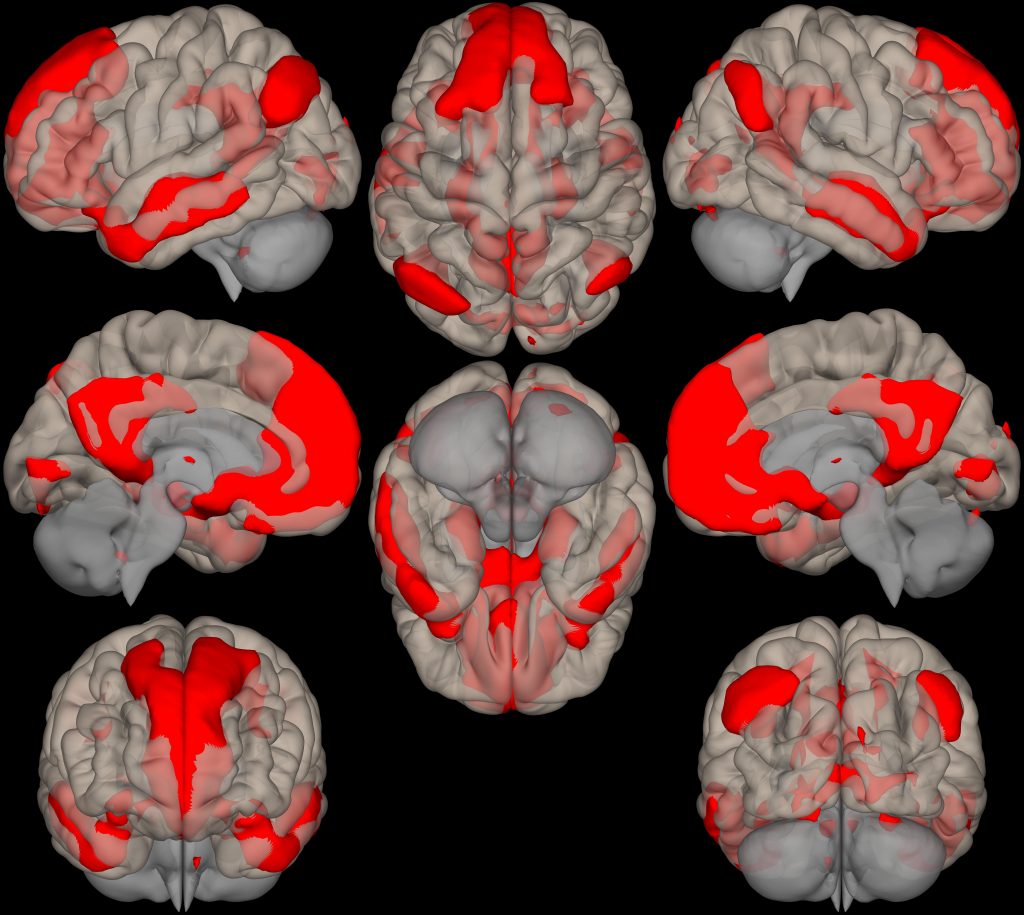 Examination of sugar and sweetener on the brain’s response - Centre for ...