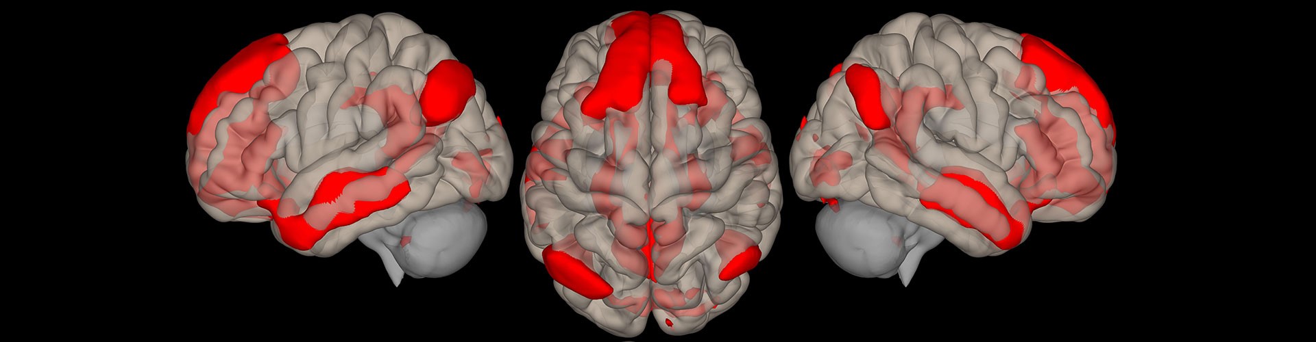 About Us - Centre for Integrative Neuroscience and Neurodynamics