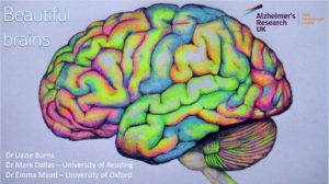 Beautiful brains: Bringing the wonders of neuroscience to ...